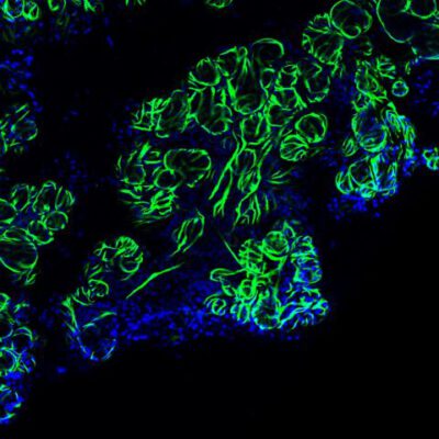 Deep Learning for Single Cell Analysis - Duke Rhodes iiD